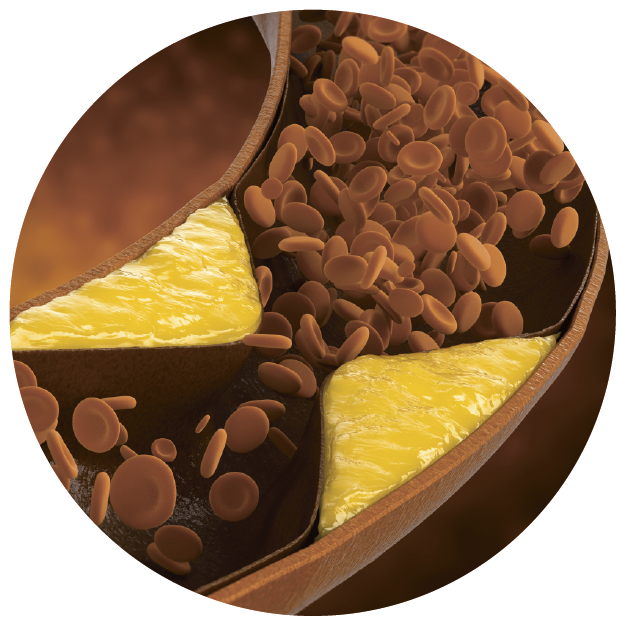 PLAQUE X TREATMENT – imwwellness