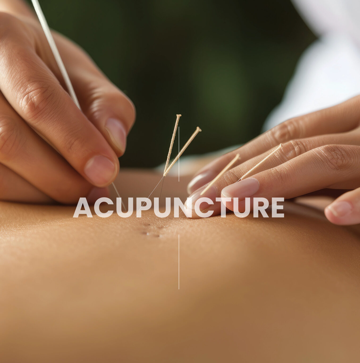 IMW Chinese Medicine – imwwellness